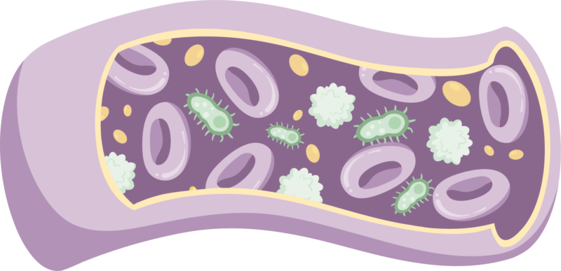 Diagnóstico de la Prostatitis Aguda Bacteriana - CUAN Hospital - Centro ...