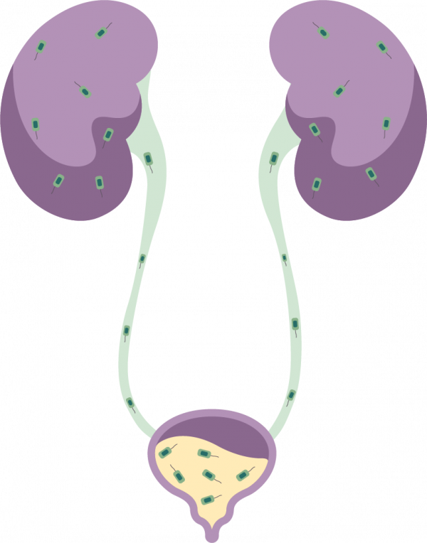 Todo lo que necesitas saber sobre la cistitis - CUAN Hospital - Centro ...