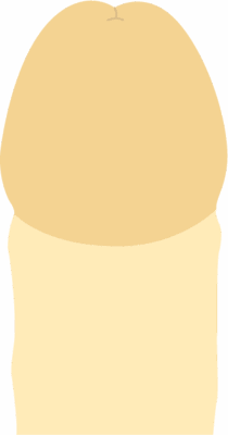 ¿Qué es el micropene? - CUAN Hospital - Centro de Urología Avanzada del ...