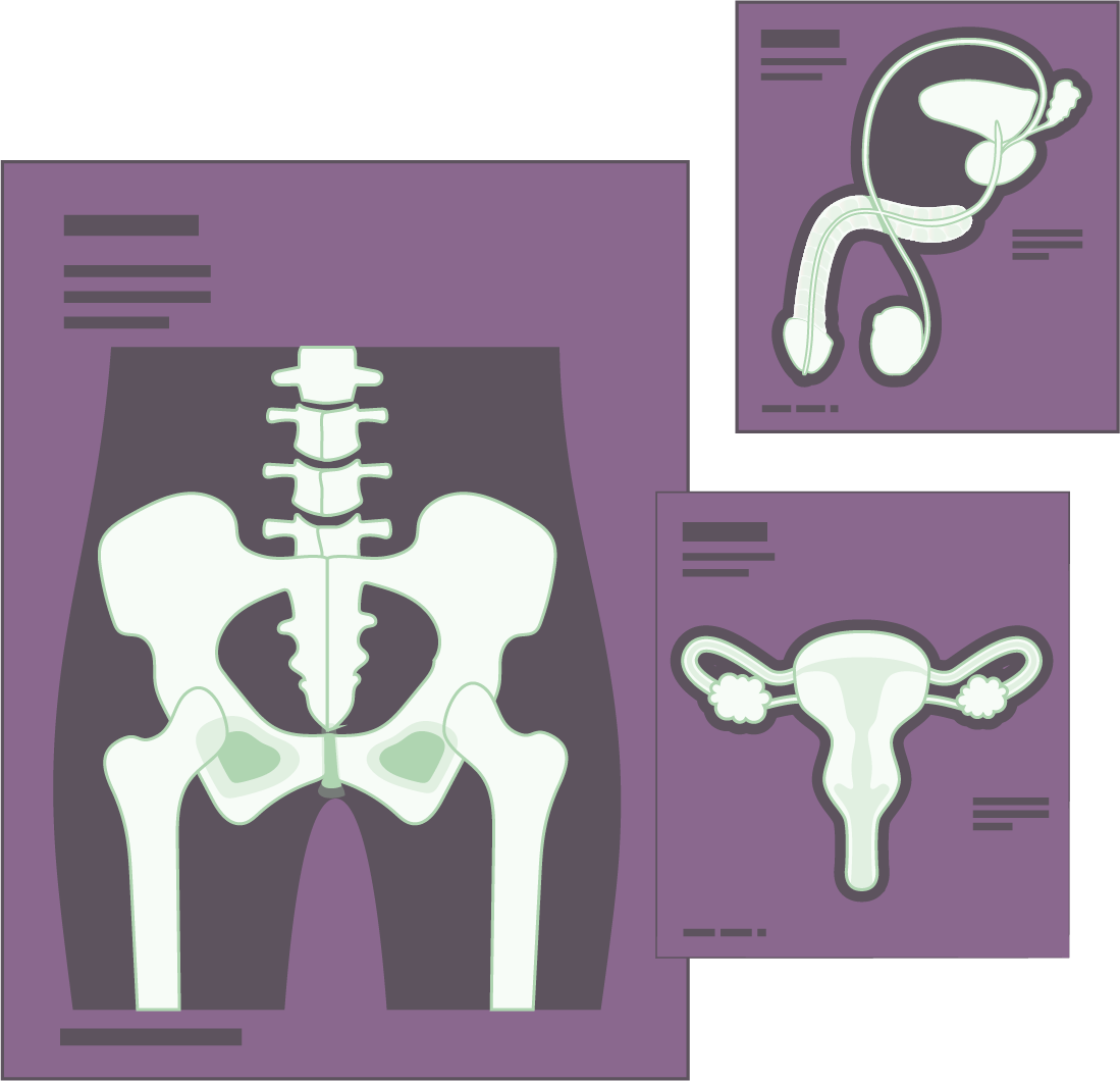 Diagnóstico y tratamiento para la Litiasis Urinaria - CUAN Hospital ...
